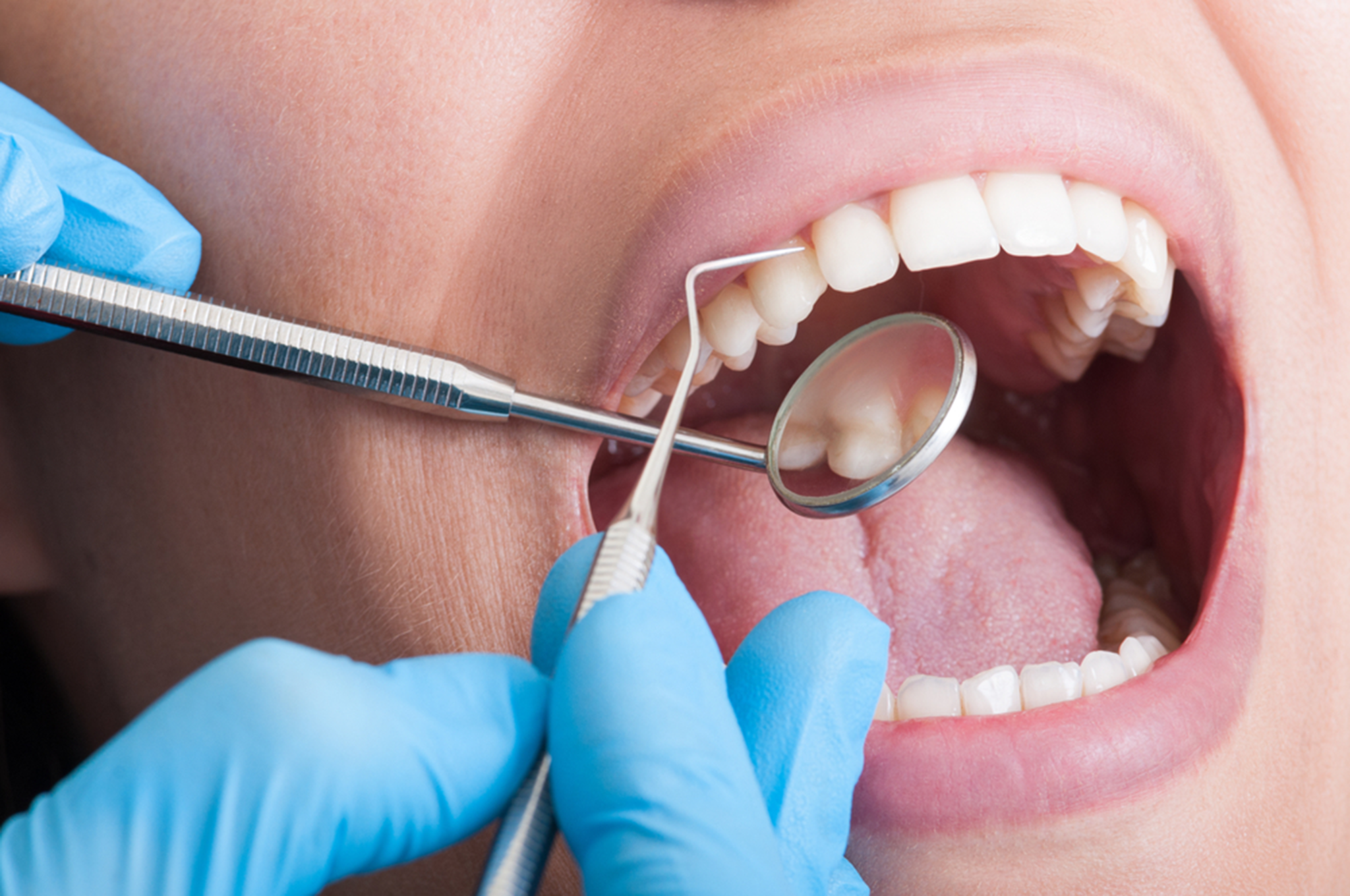 Most Common Dental Problems That Go Unnoticed